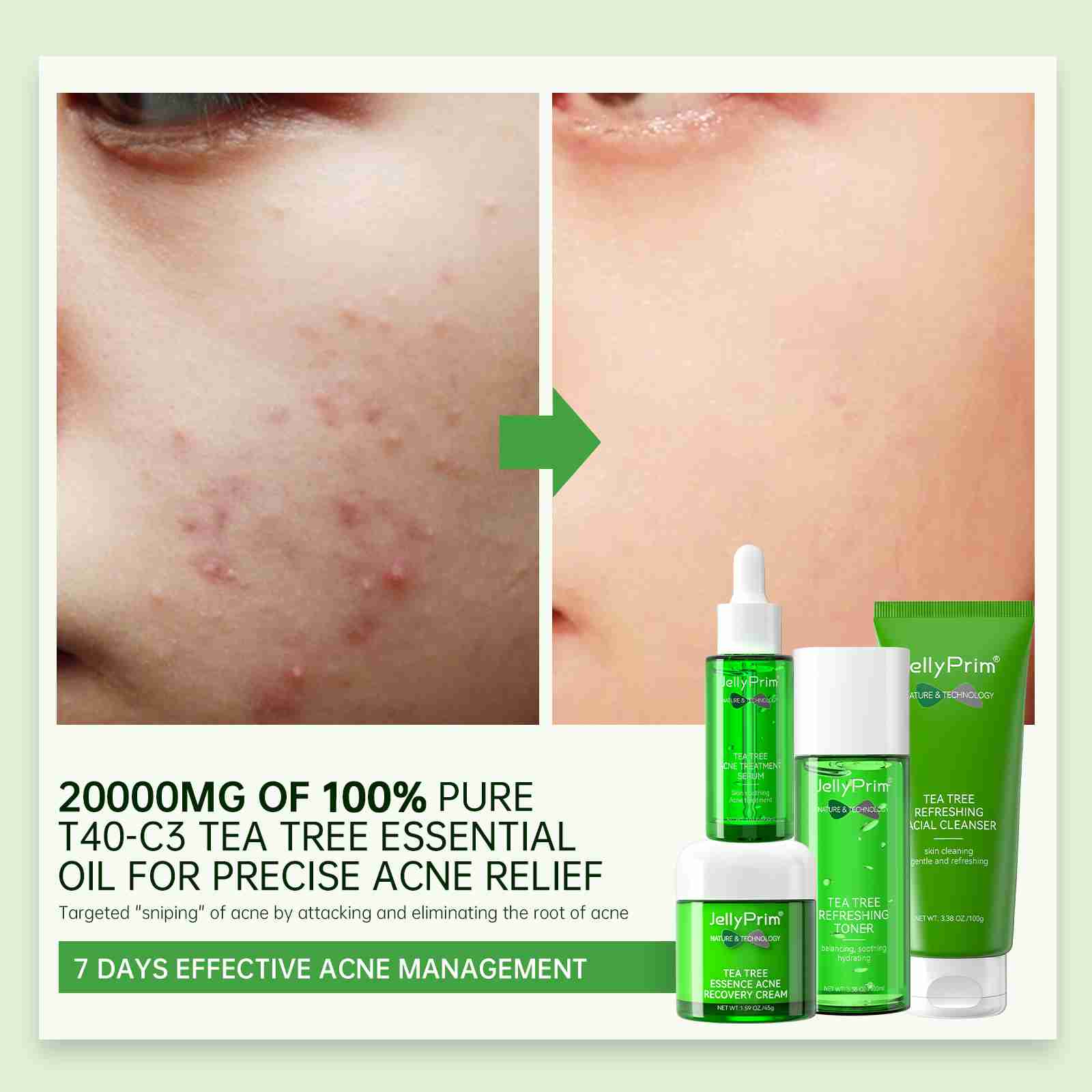 JellyPrim OEM Tea Tree Essential Oil Acne Removal Skin Care Set ...