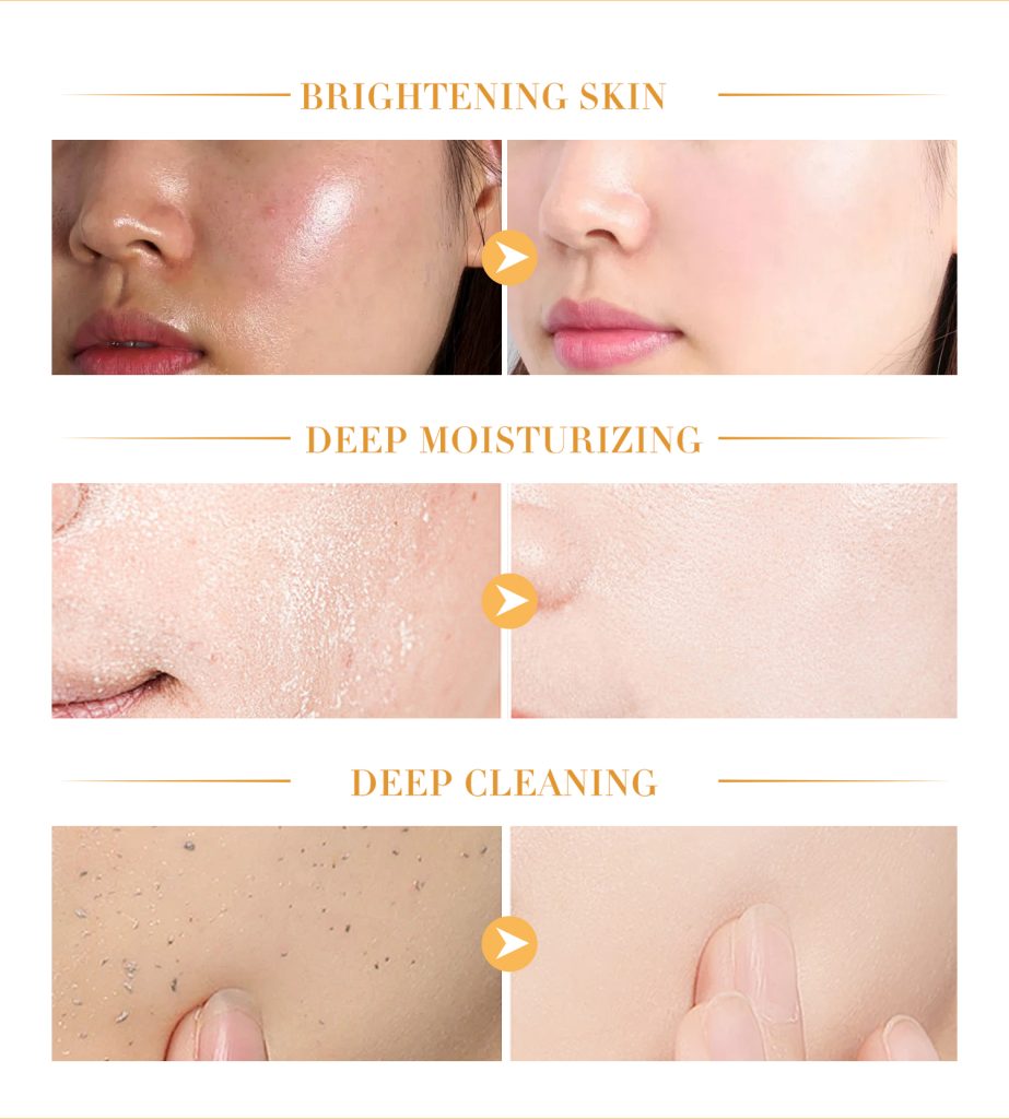 Transform Your Skin with Our Vitamin C Skin Care Set | Achieve Radiant ...